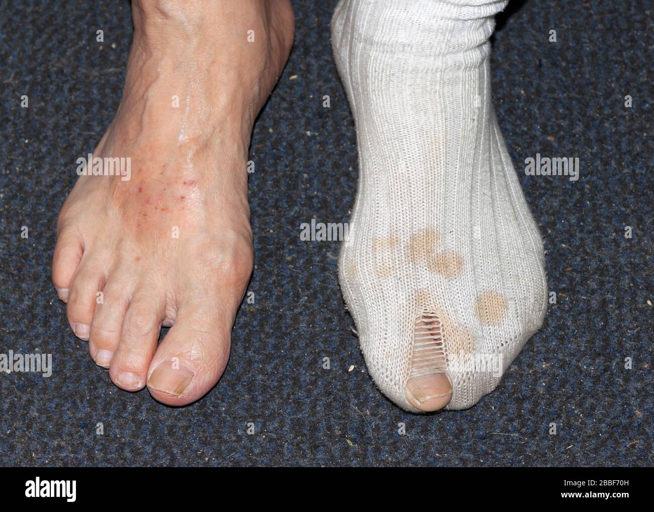 Symbolic photo for neglect Stock Photo - Alamy