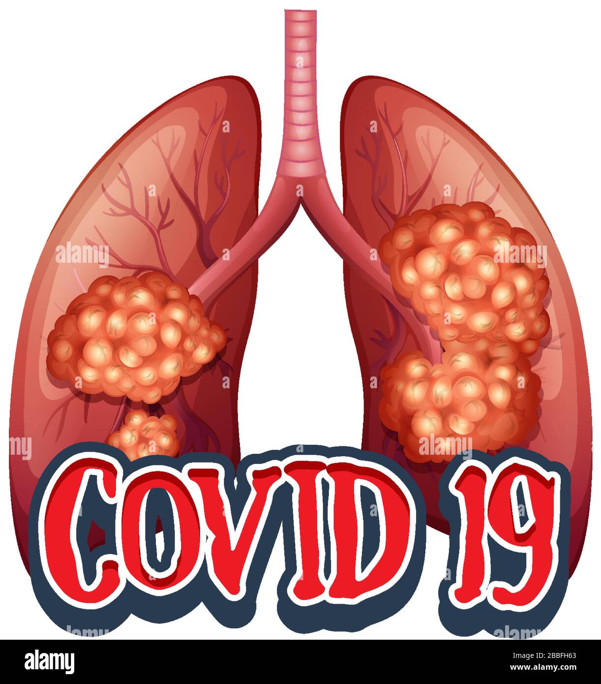 Poster design for coronavirus theme with bad lungs illustration Stock ...