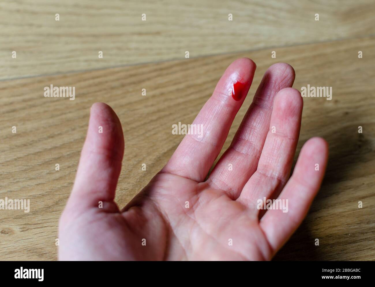 Knife finger accident hi-res stock photography and images - Alamy