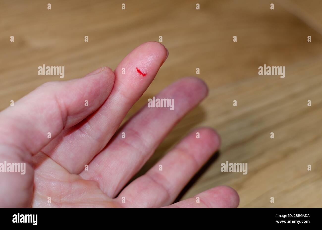 Real surgery hi-res stock photography and images - Alamy
