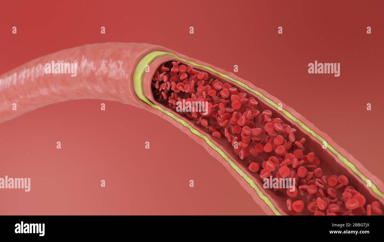 Cross section artery hi-res stock photography and images - Alamy