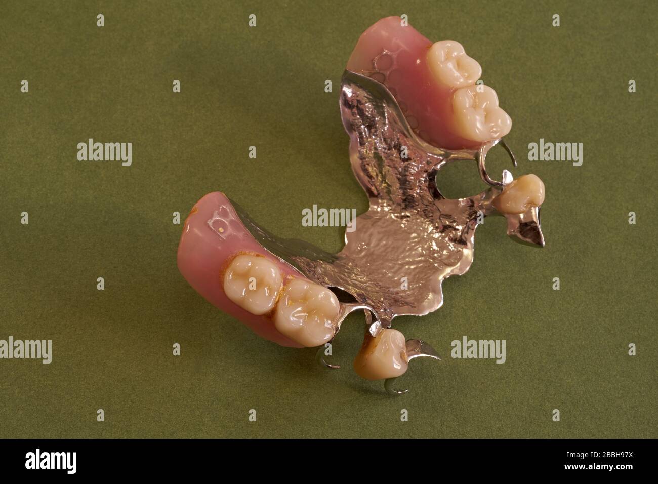 Close up of a used tooth prosthesis Stock Photo - Alamy