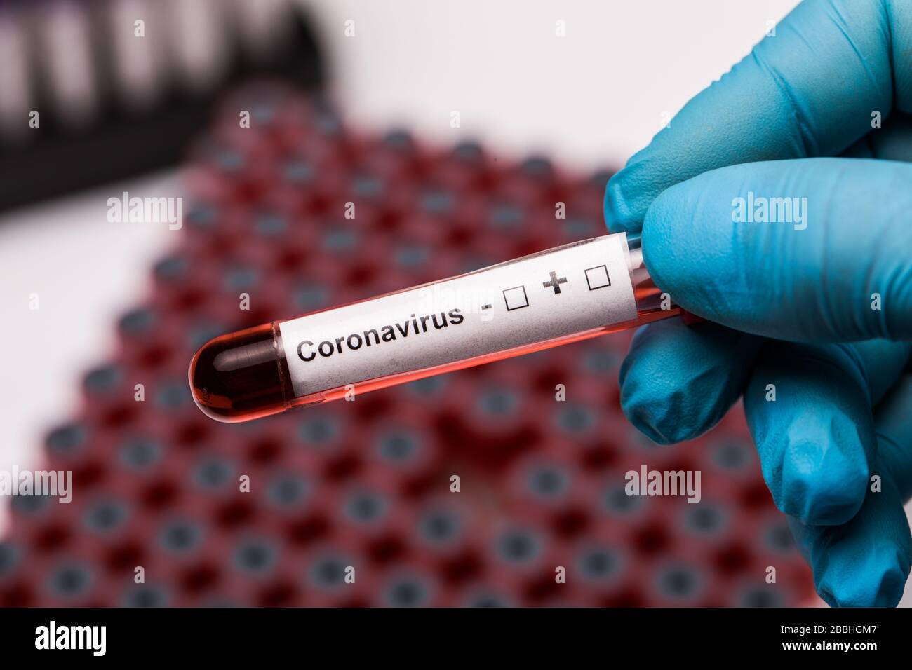 Covid 19 infected blood sample in sample tube on table in research ...