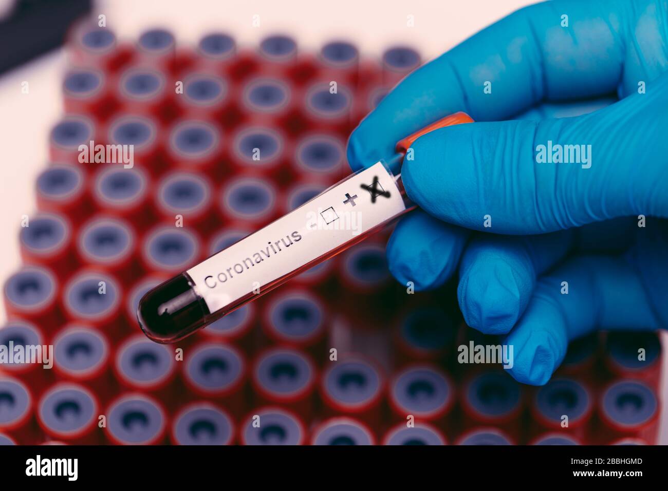 Covid 19 infected blood sample in sample tube on table in research ...