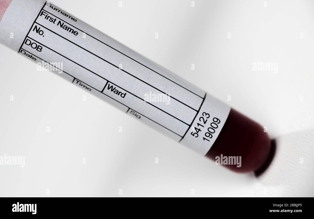 Blood drawing sample test probe collection with blank label tag for ...