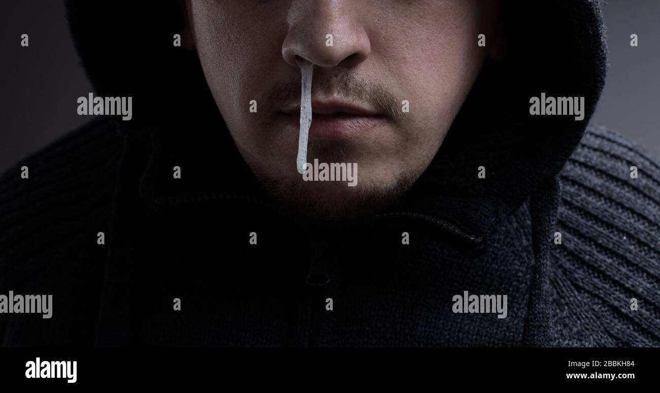 face of a man with running nose with long white mucus. concept of ...