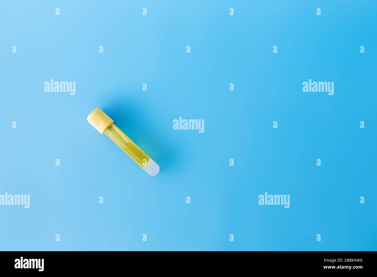 Test tube smear test hi-res stock photography and images - Alamy