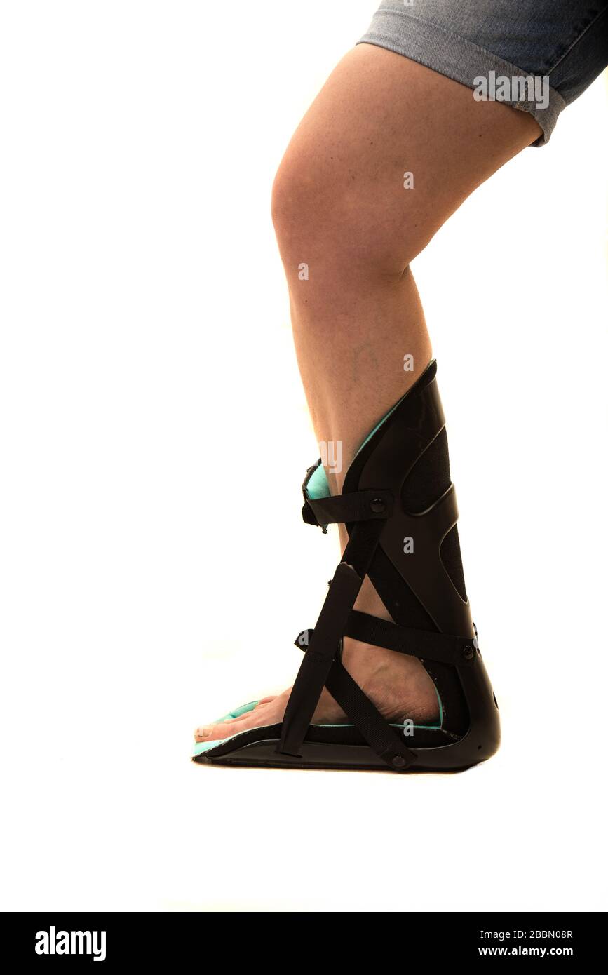 Profile of woman leg in feet orthosis isolated on white background ...