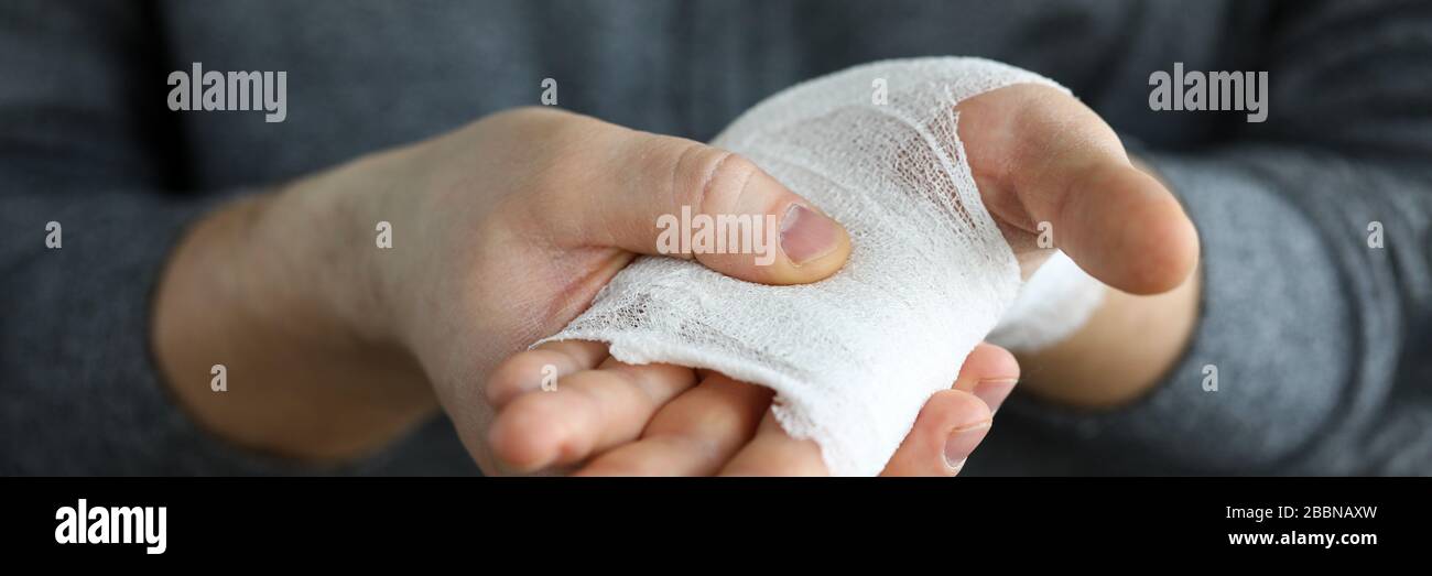 Man shows wounded arm rewound with white bandage Stock Photo - Alamy