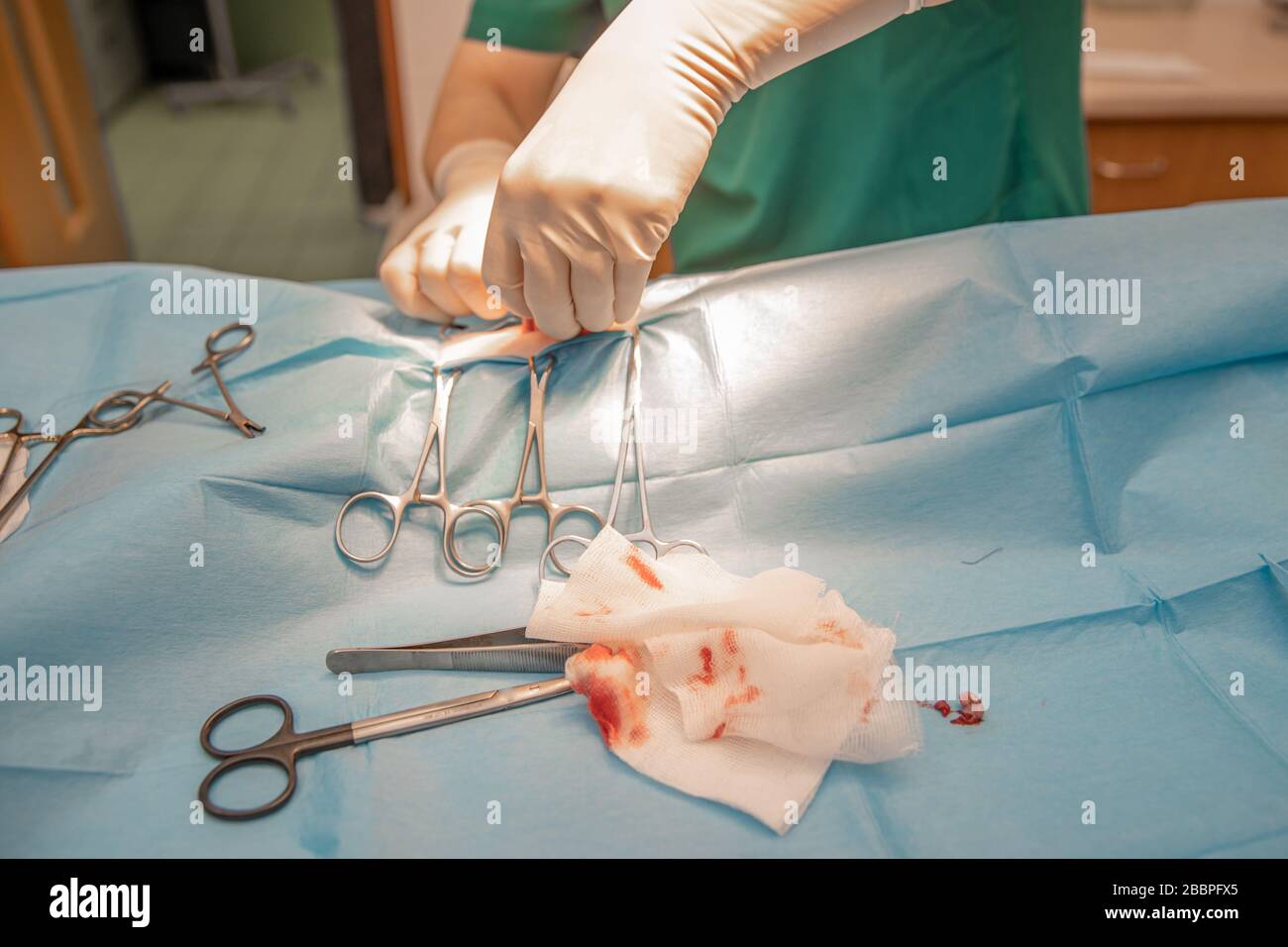 closeup of hands and surgical instruments during abdominal surgery in ...