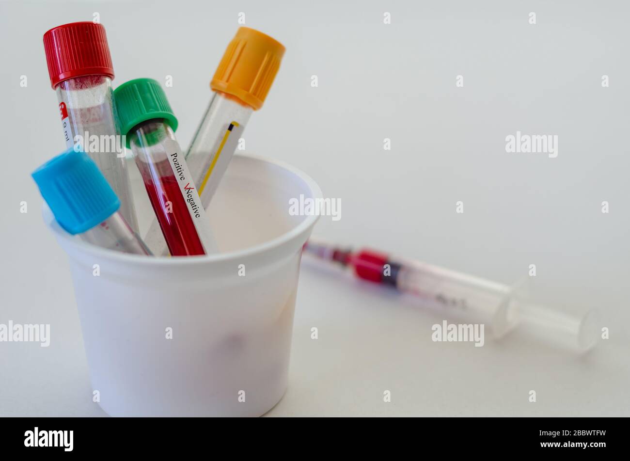 Blood sample tubes hi-res stock photography and images - Alamy