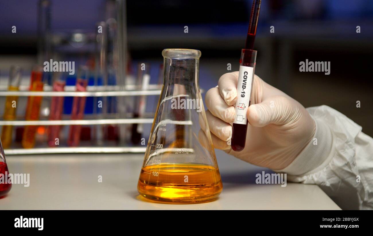Real time blood test hi-res stock photography and images - Alamy