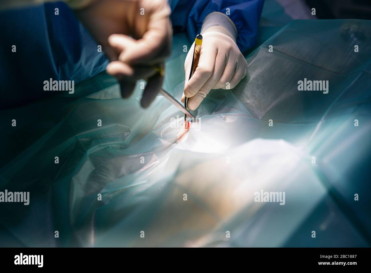 Close up surgery instruments hi-res stock photography and images - Alamy