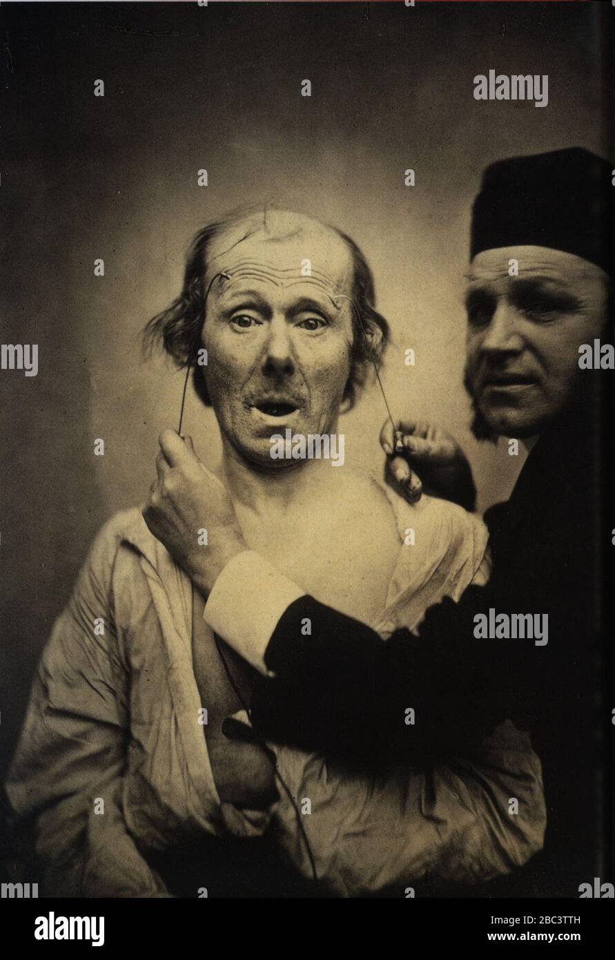 Boulogne Duchenne De High Resolution Stock Photography and Images - Alamy