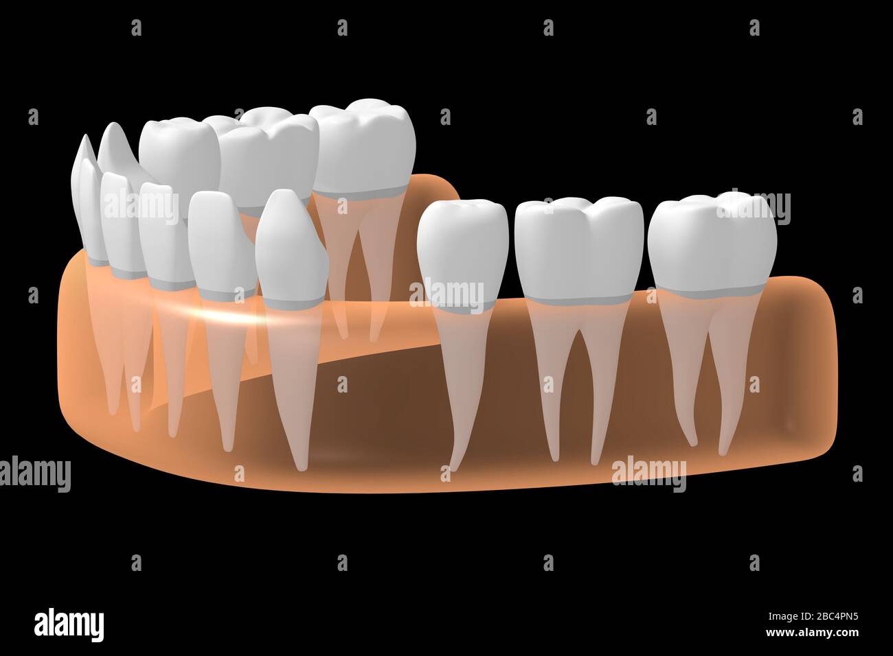 Missing jaw hi-res stock photography and images - Alamy