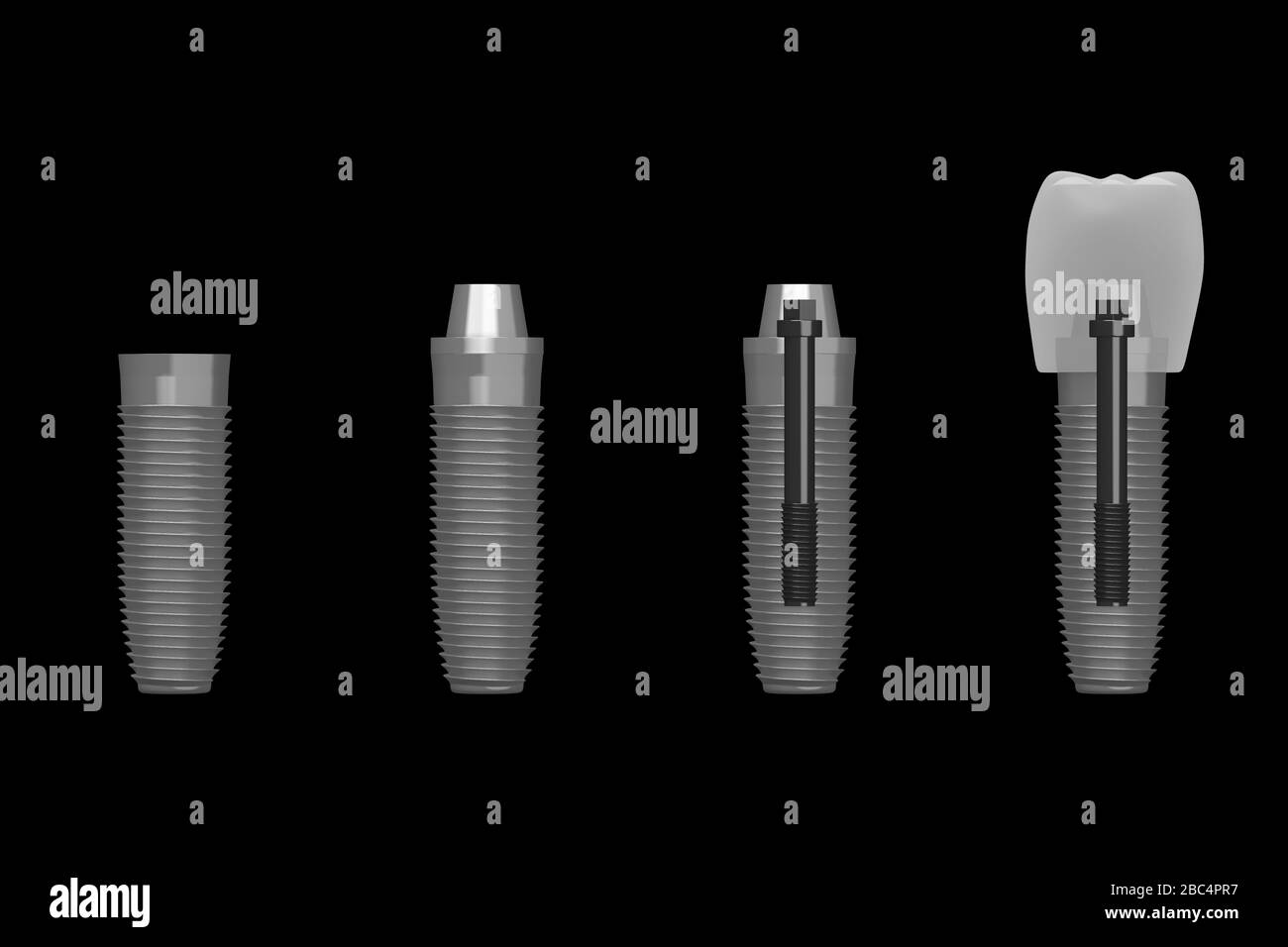 Dental process Black and White Stock Photos & Images - Alamy