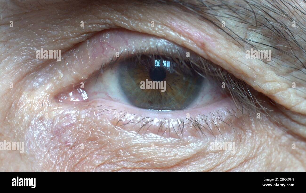 Eye closeup human skin old hi-res stock photography and images - Alamy Eye closeup human skin old hi-res stock photography and images - Alamy