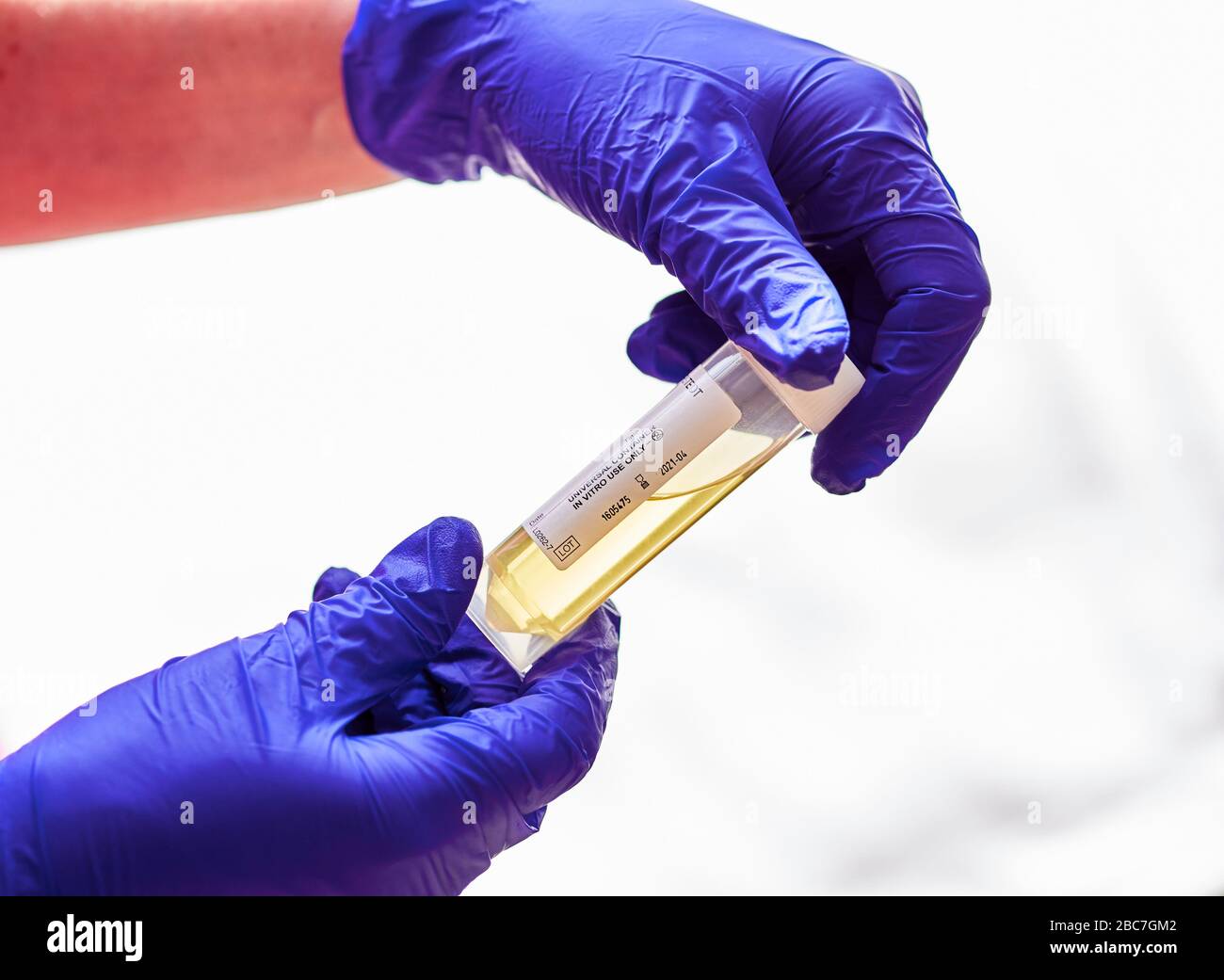 Nurse holding specimen container Stock Photo - Alamy