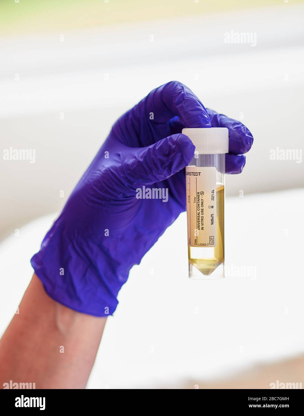 Nurse holding specimen container Stock Photo - Alamy