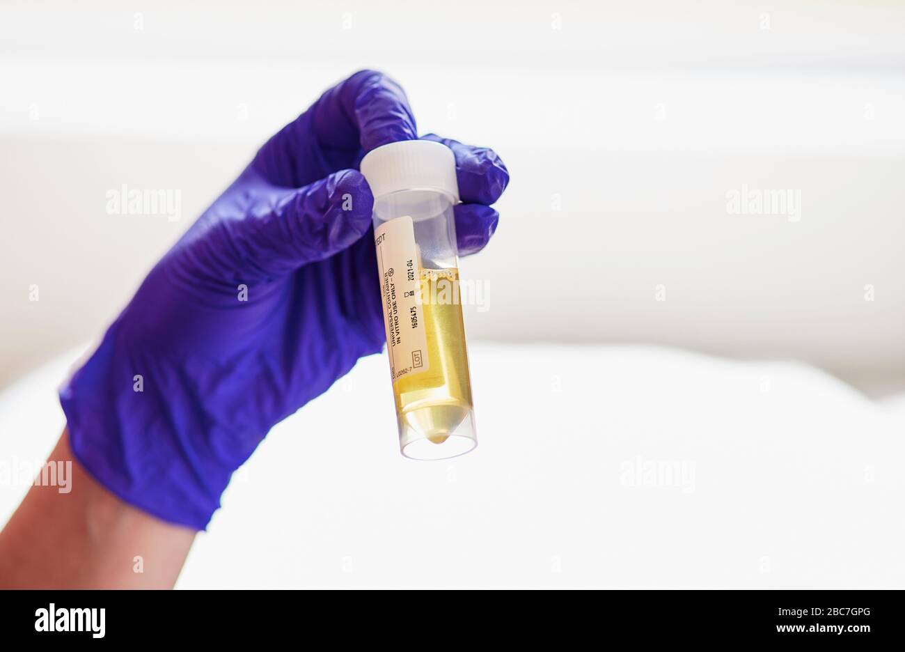 Nurse holding specimen container Stock Photo - Alamy