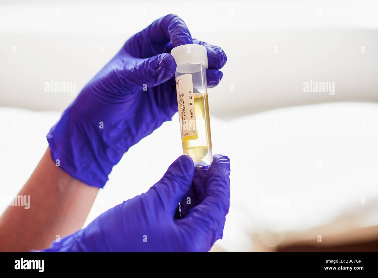 Nurse holding specimen container Stock Photo - Alamy