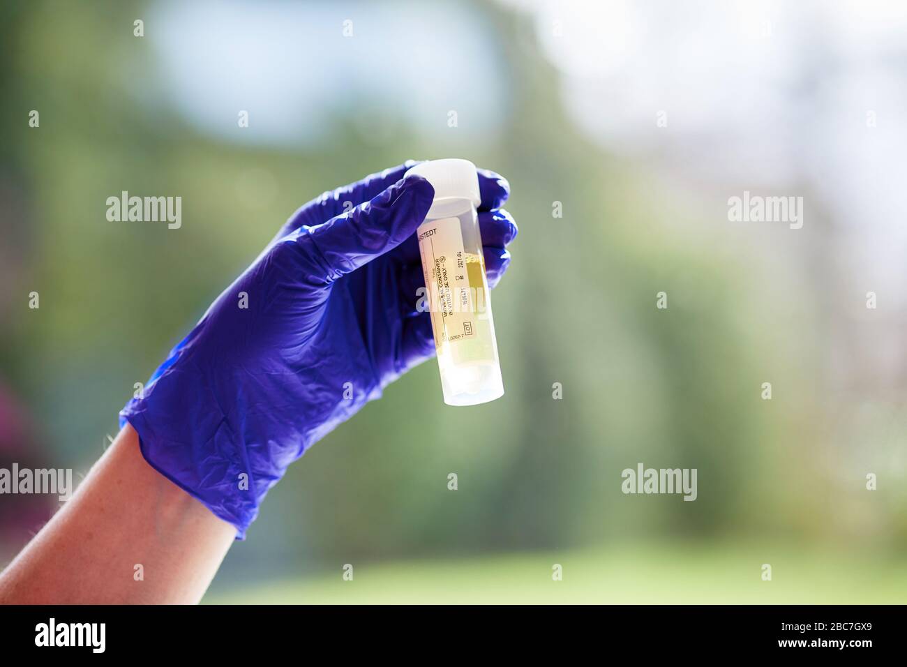 Nurse holding specimen container Stock Photo - Alamy