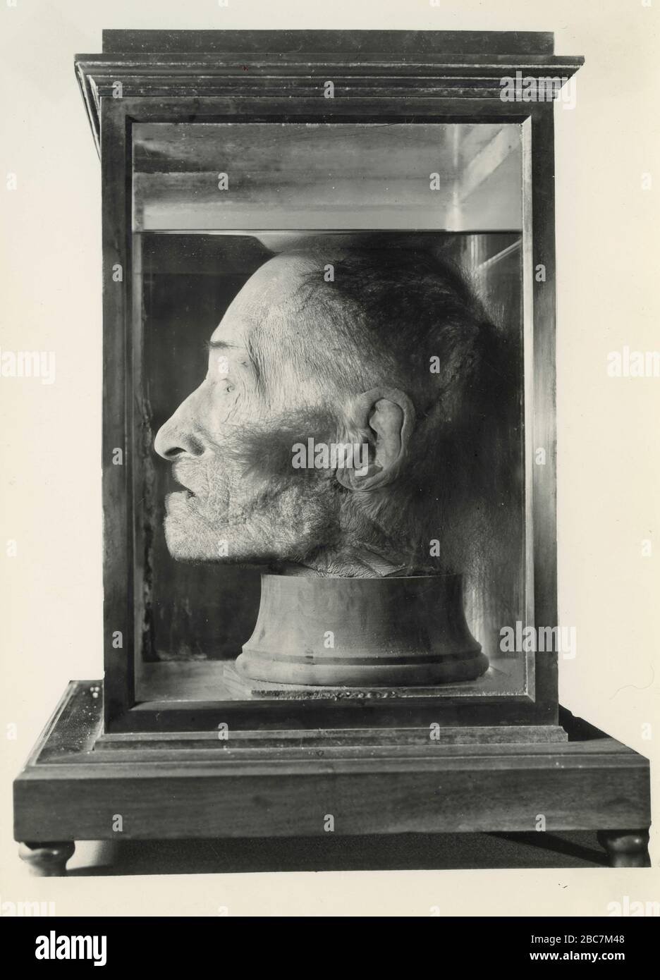 Head of Italian Physician Antonio Scarpa preserved in formalin ...