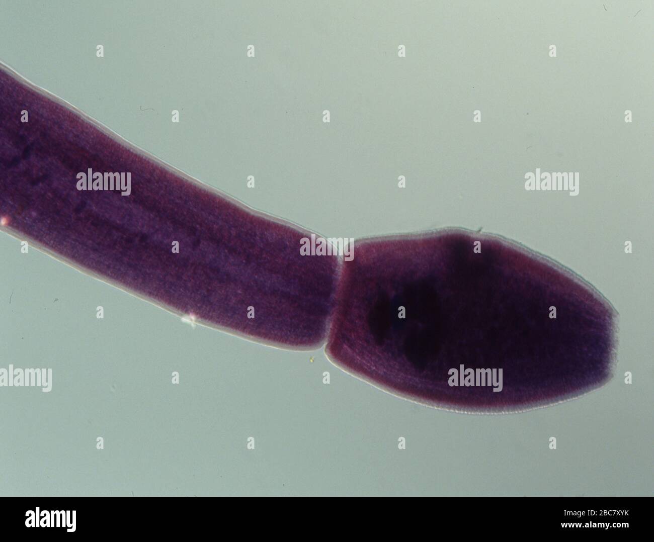 Tapeworm hi-res stock photography and images - Alamy
