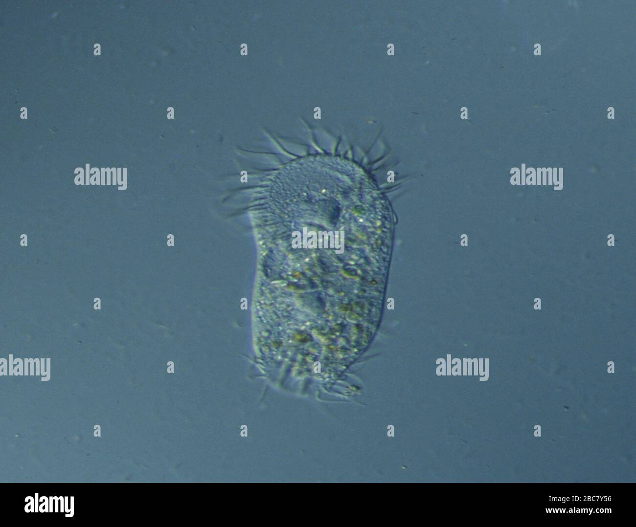 Ciliates and amoebas in drops of water under the microscope Stock Photo ...