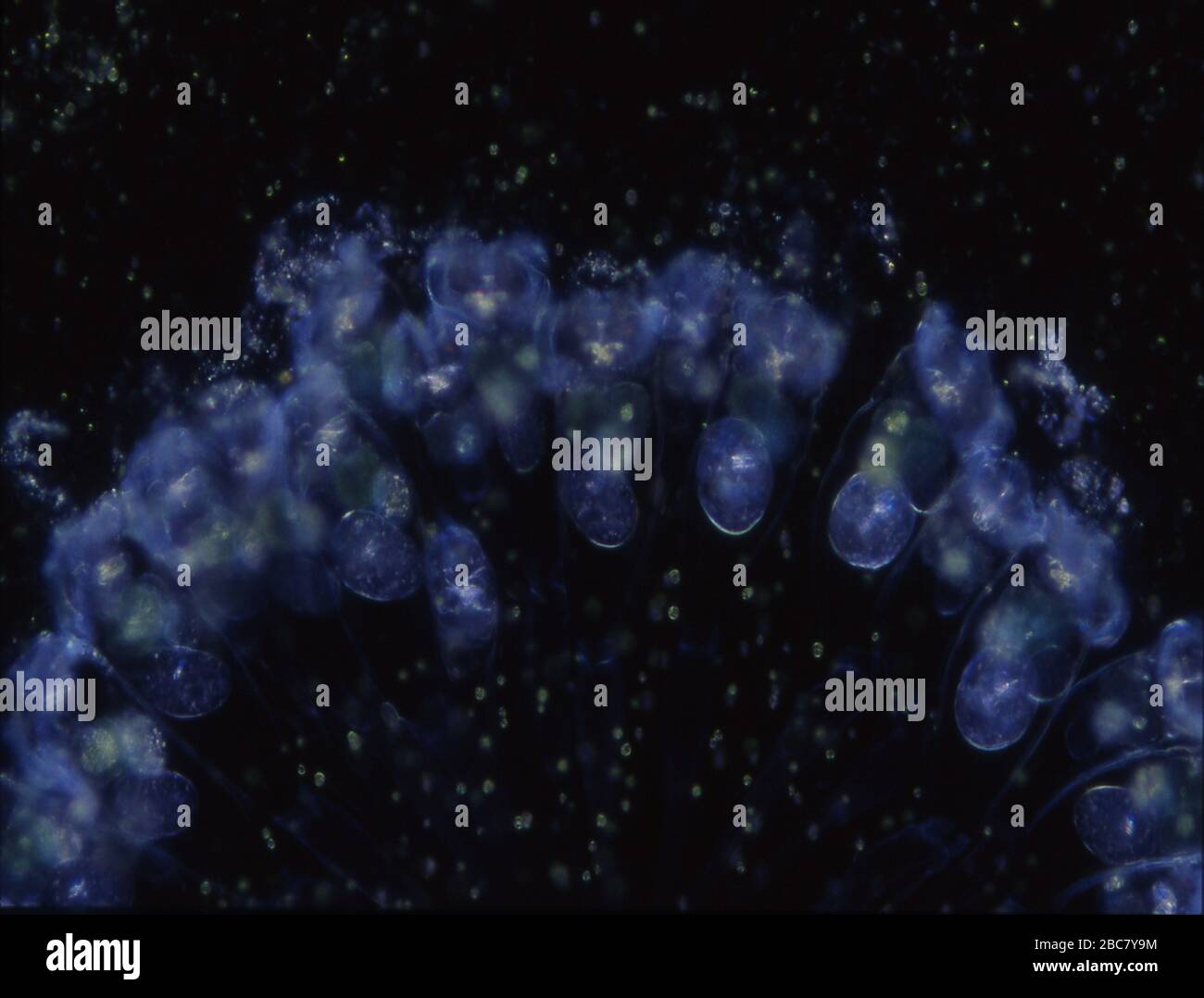 Ciliates and amoebas in drops of water under the microscope Stock Photo ...