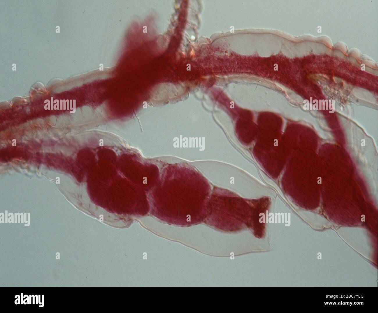 red polyp stick under the microscope Stock Photo - Alamy
