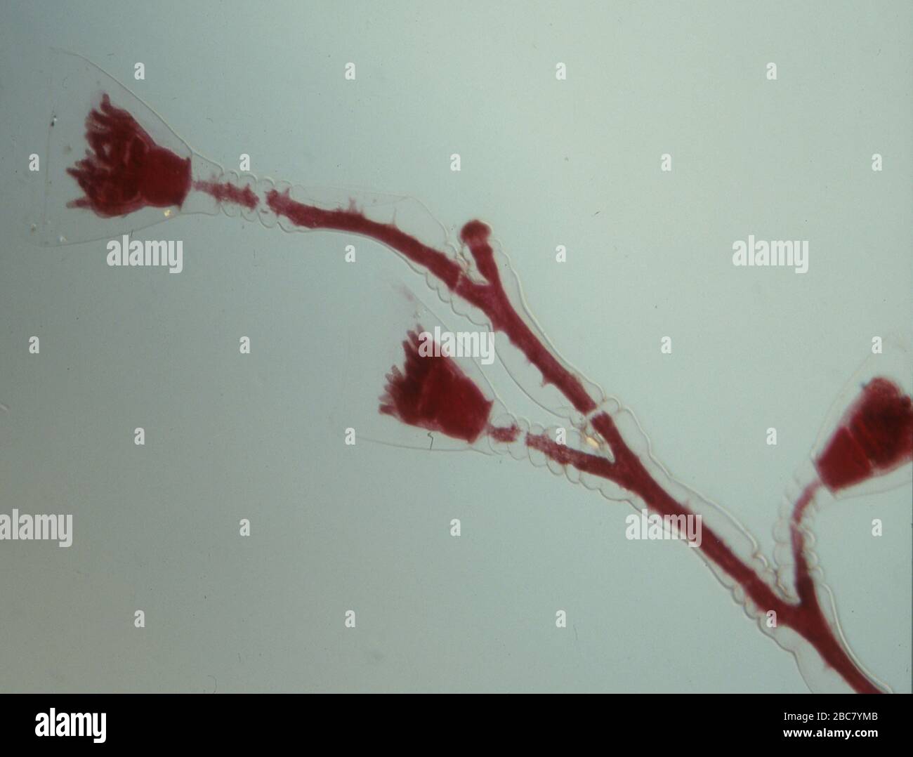 red polyp stick under the microscope Stock Photo - Alamy