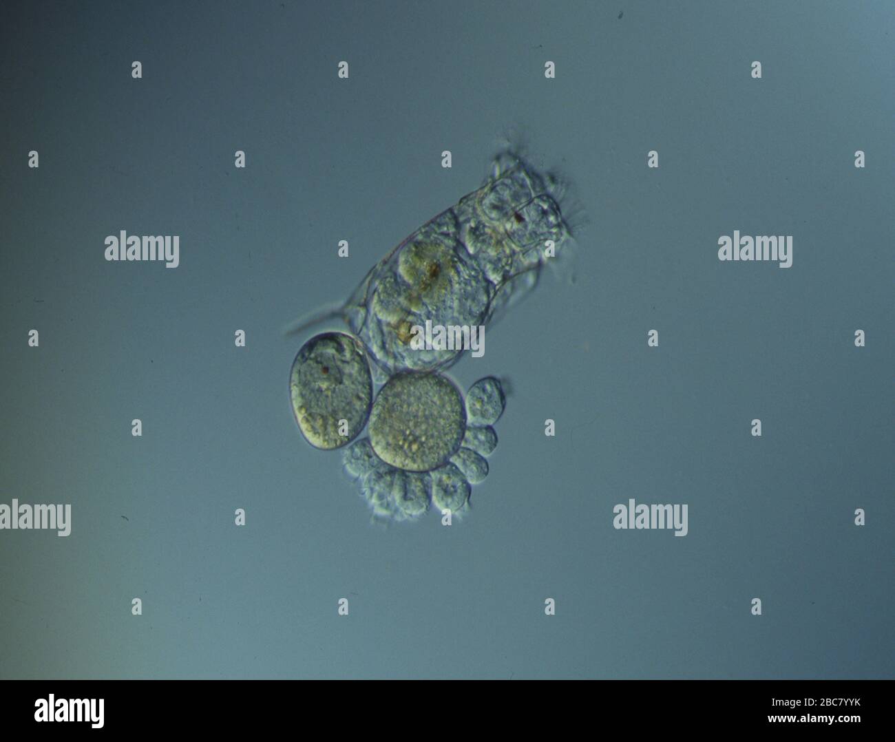 Rotifers swim in the water under the microscope Stock Photo - Alamy