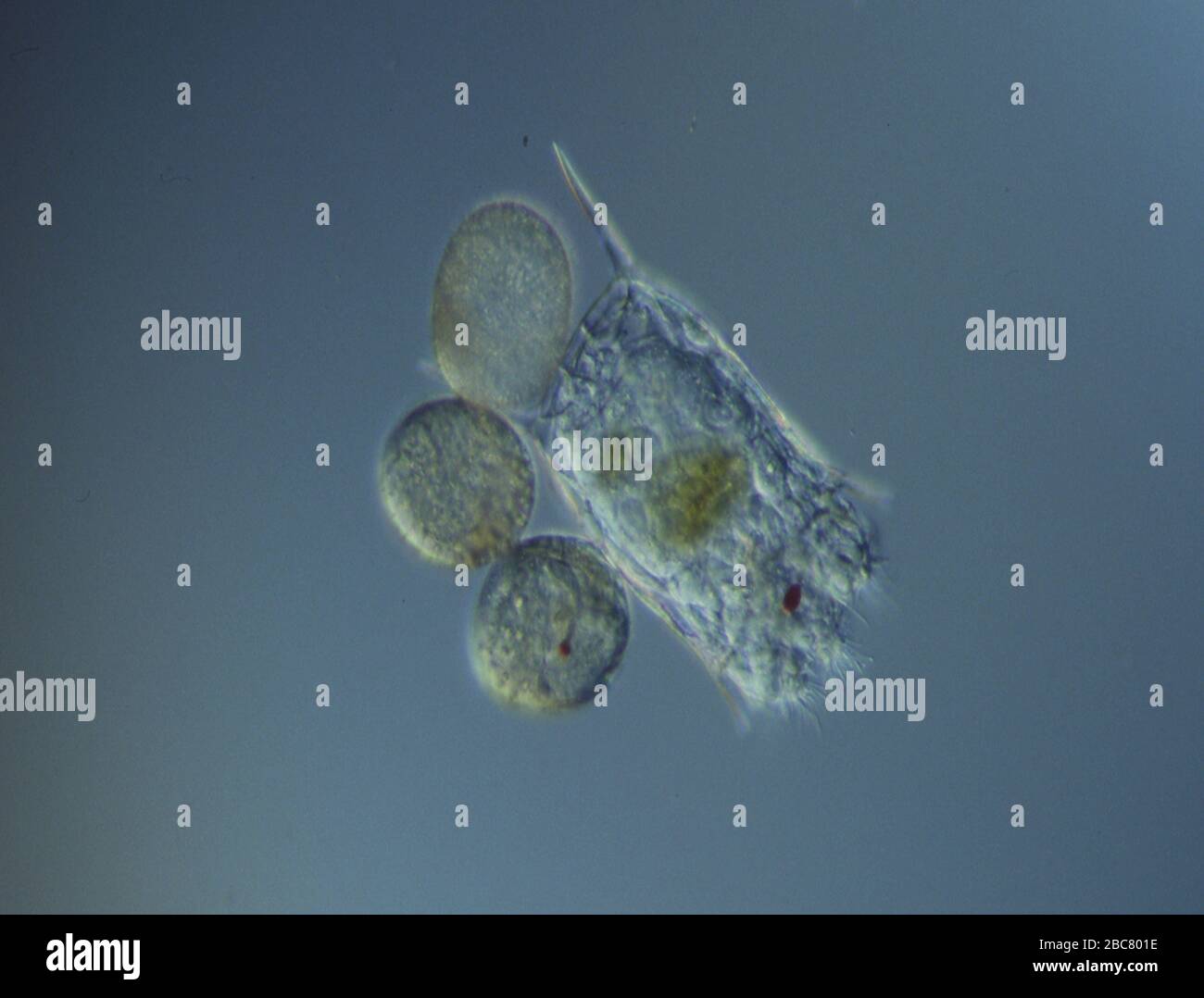 Rotifers swim in the water under the microscope Stock Photo - Alamy