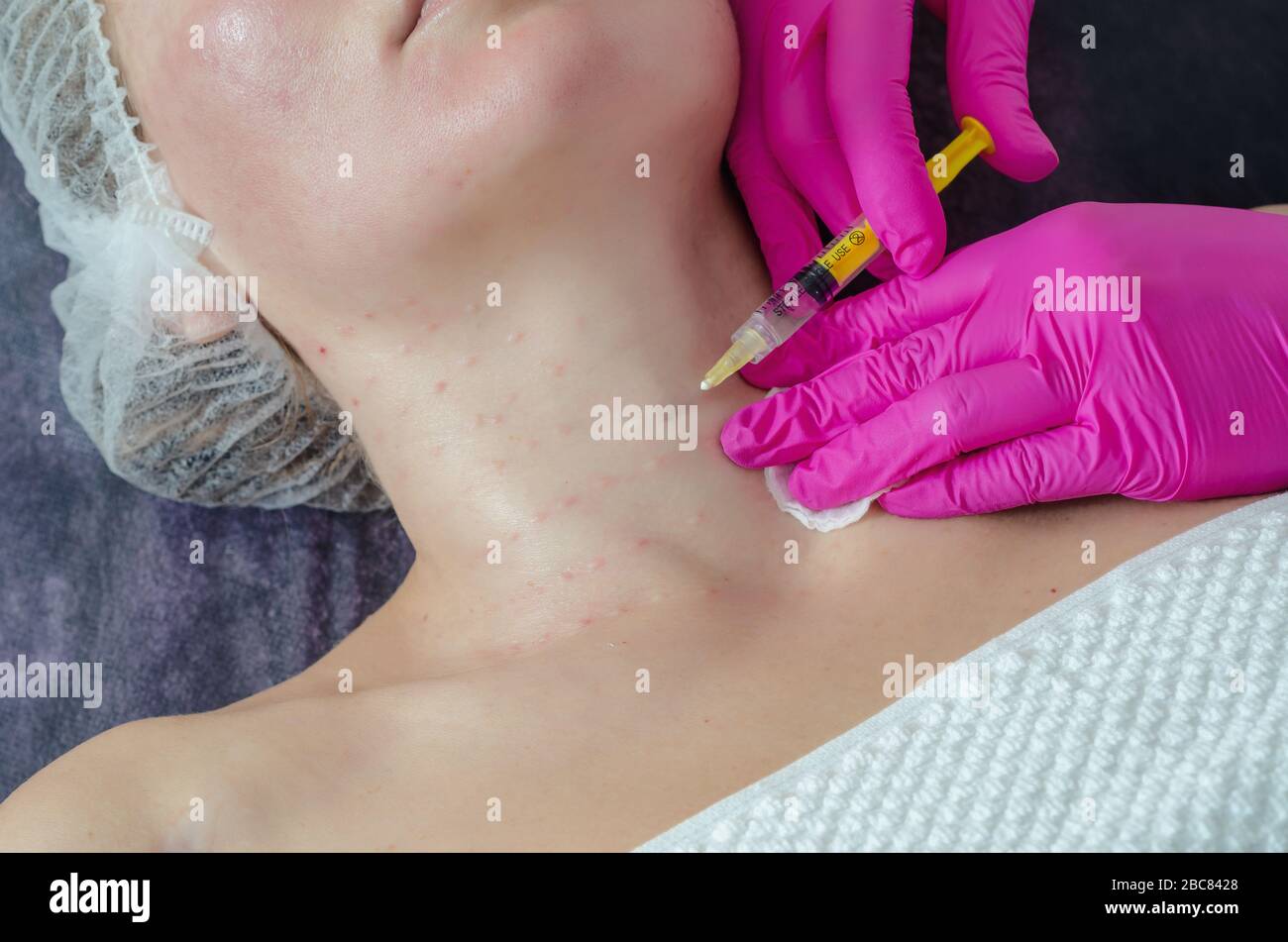 Mesotherapy of the face and neck. Beautician makes injection of beauty ...