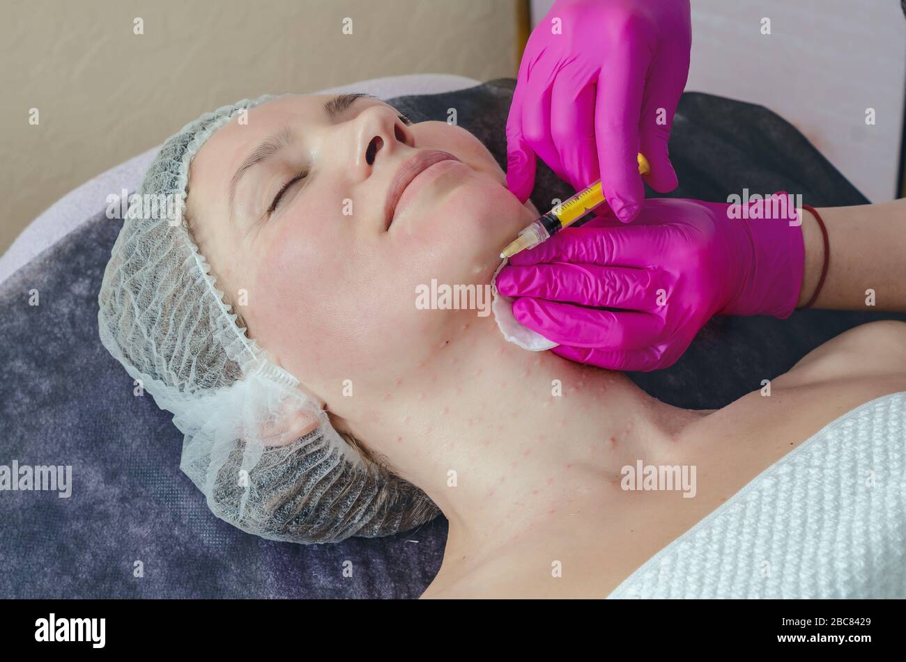 Mesotherapy of the face and neck. Beautician makes injection of beauty ...
