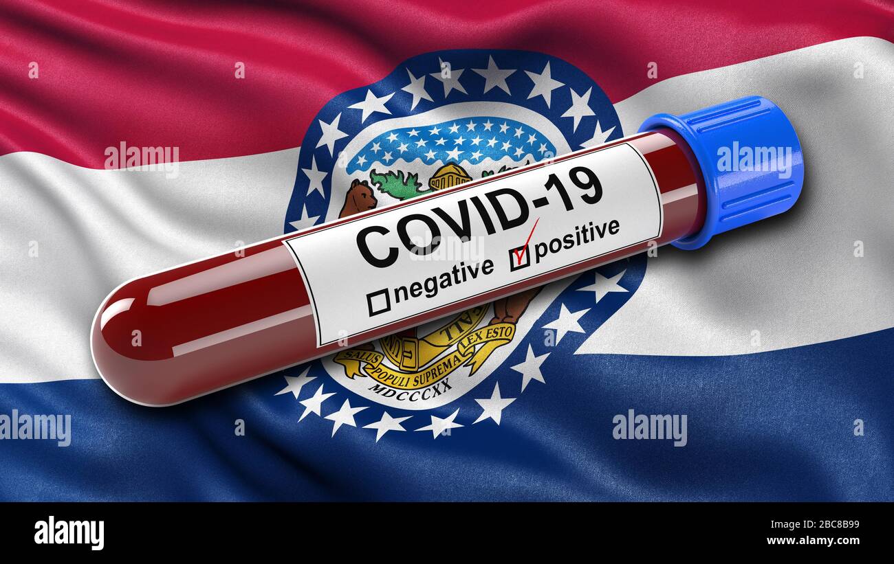 US state flag of Missouri waving in the wind with a positive Covid-19 ...