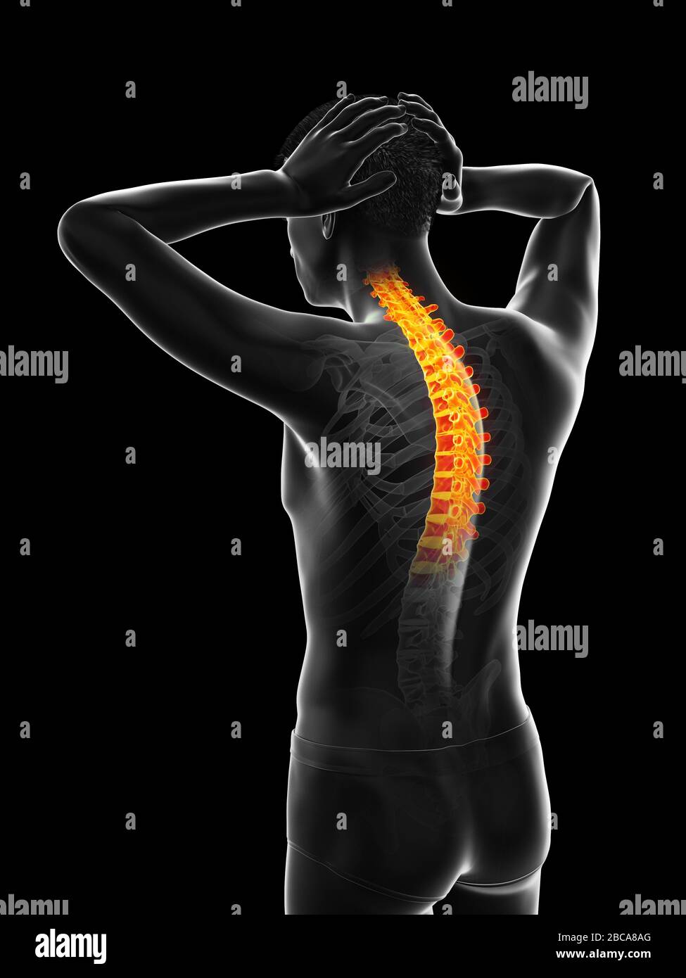 Backache and painful human condition hi-res stock photography and ...