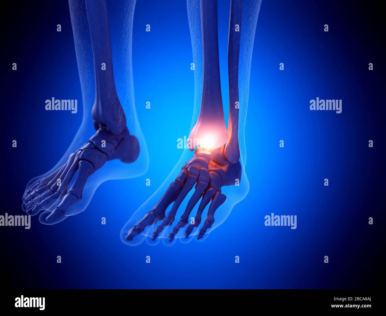 Painful ankle, illustration Stock Photo - Alamy