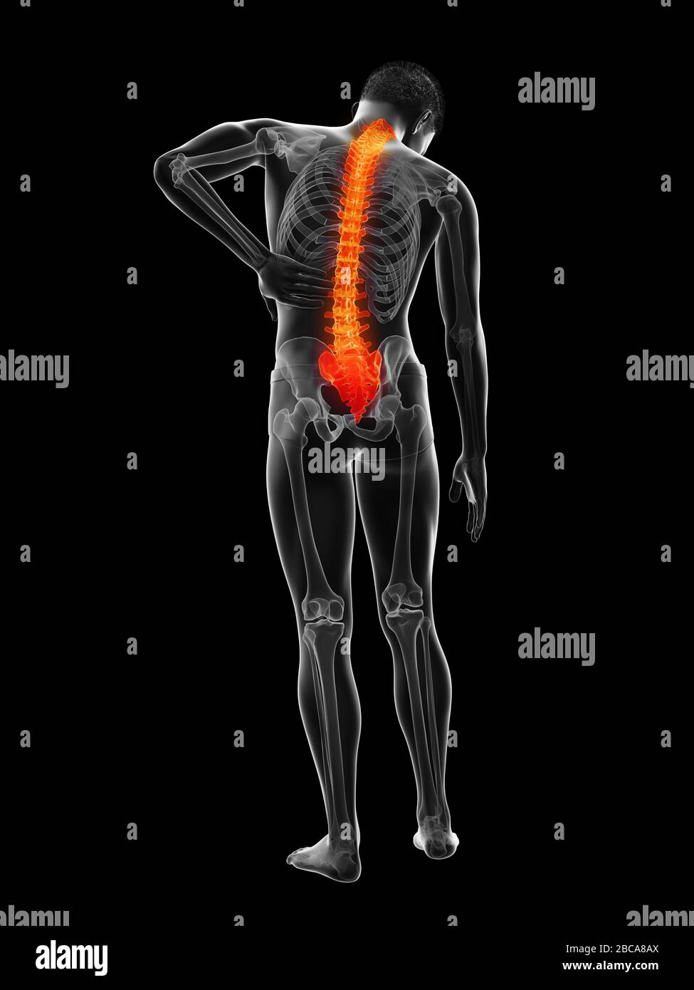 Painful back, illustration Stock Photo - Alamy