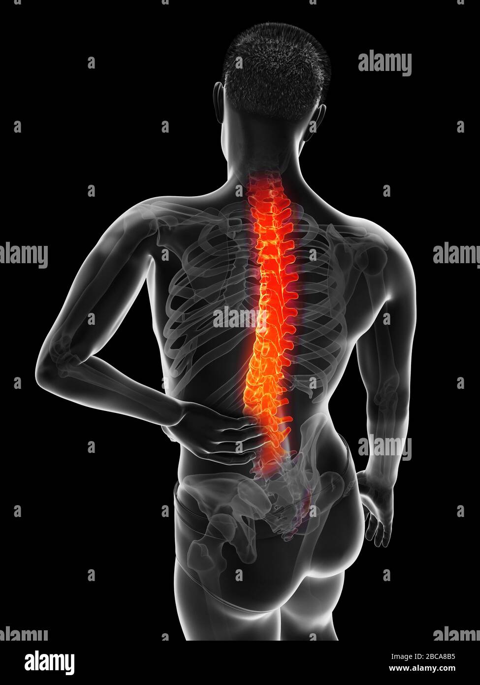 Painful back, illustration Stock Photo - Alamy