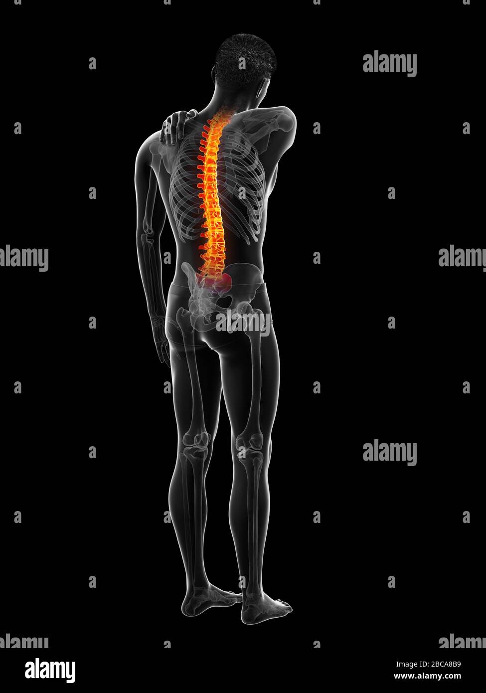 Man with backache, illustration Stock Photo - Alamy