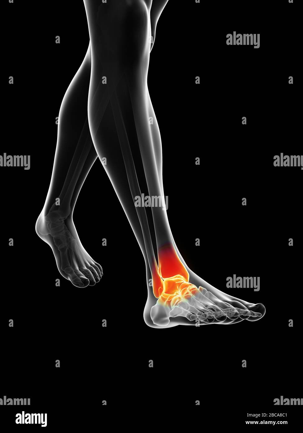 Painful ankle, illustration Stock Photo - Alamy
