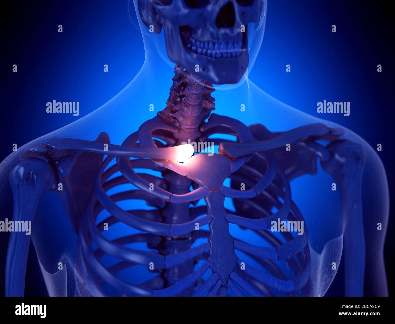 Painful clavicle joint, illustration Stock Photo - Alamy