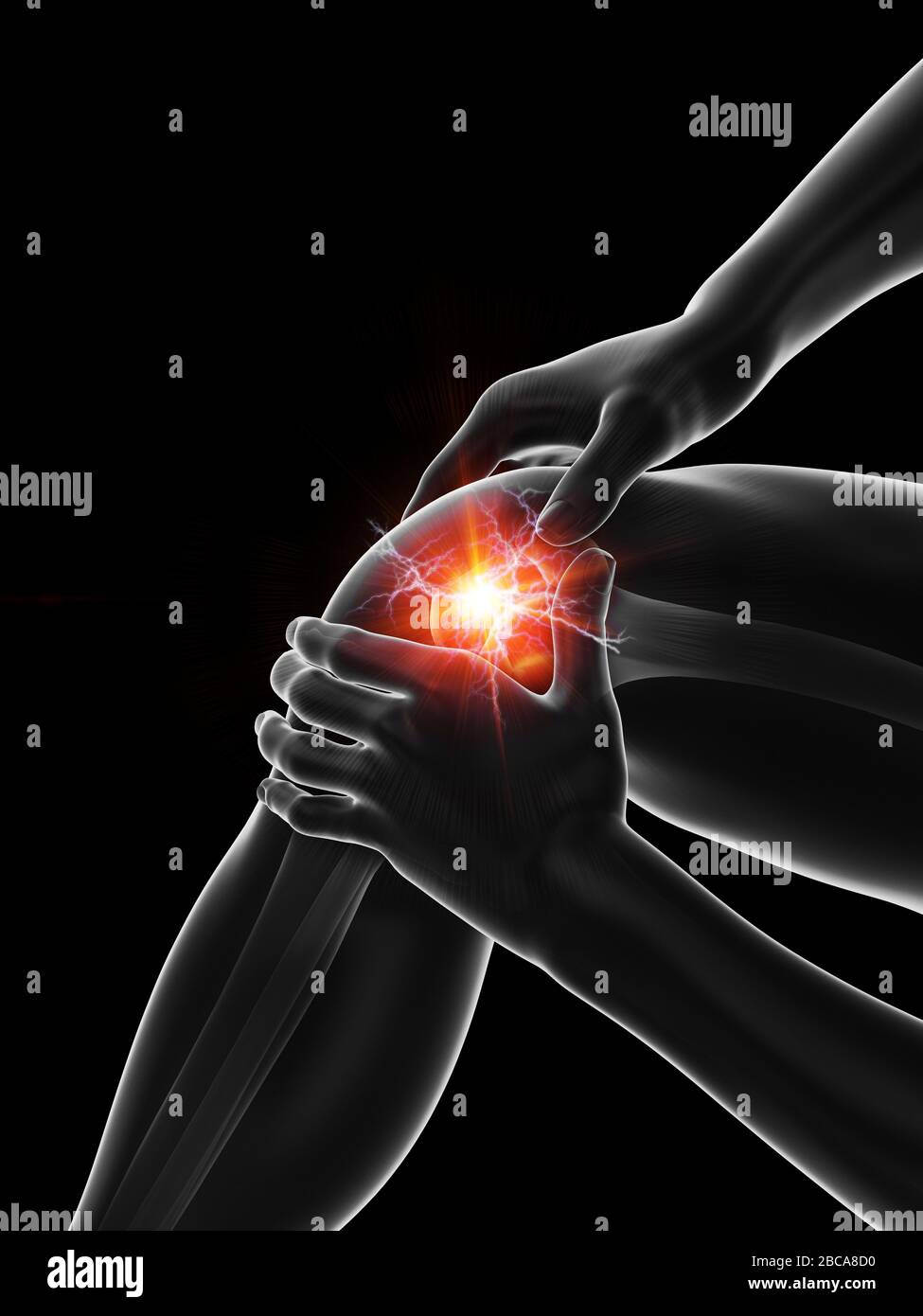 Painful knee, illustration Stock Photo - Alamy