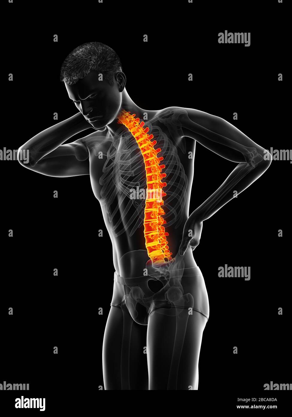 Backache and painful human condition hi-res stock photography and ...
