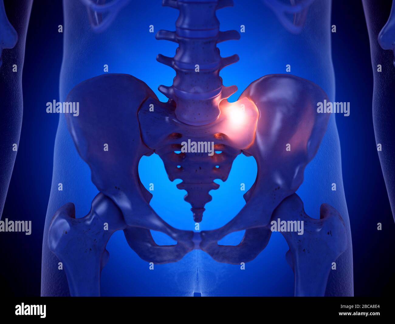 Sacroiliac joint pain hi-res stock photography and images - Alamy