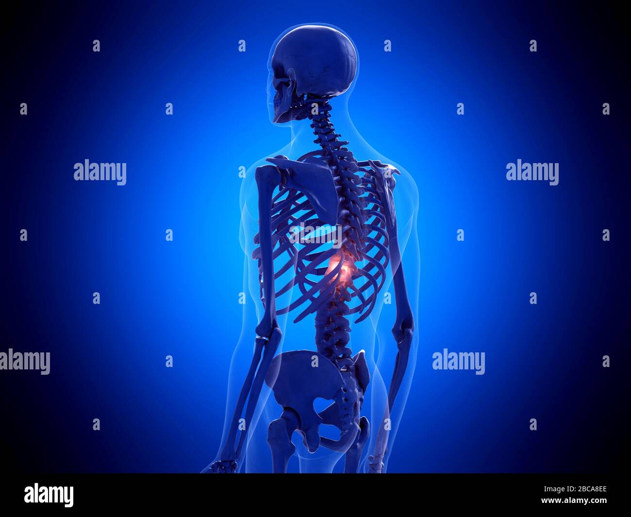 Painful spine, illustration Stock Photo - Alamy