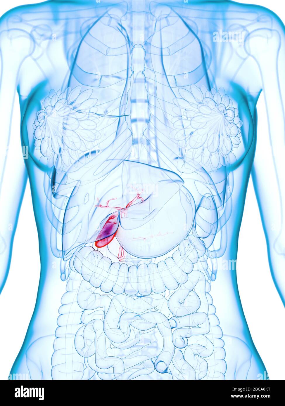 Diseased gallbladder, illustration Stock Photo - Alamy
