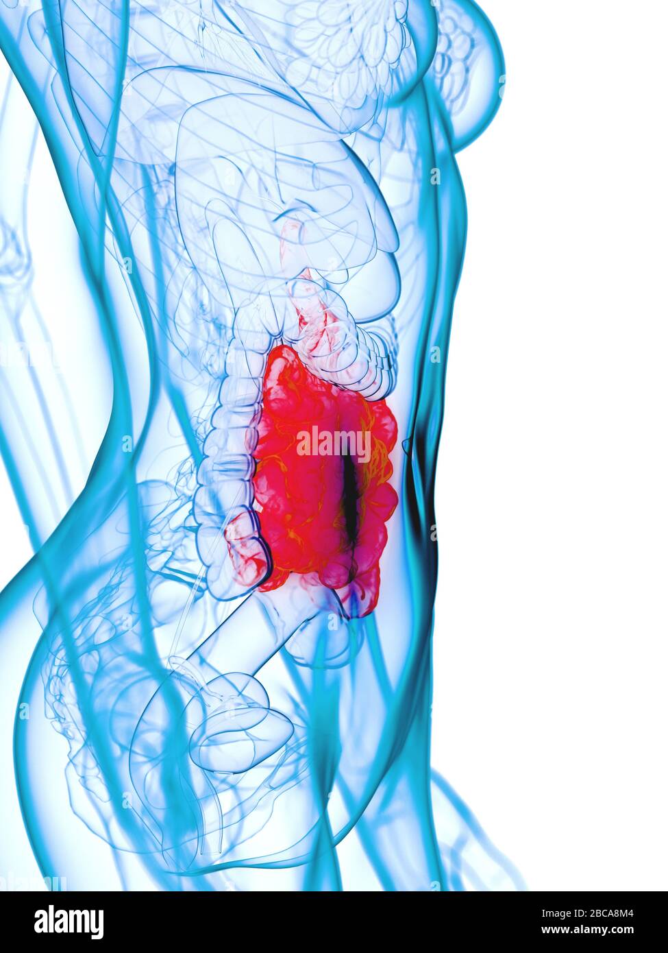 Inflammation small intestine hi-res stock photography and images - Alamy